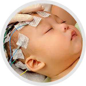 Eletroencefalograma (EEG) | Córtex Neurologia Diagnóstica